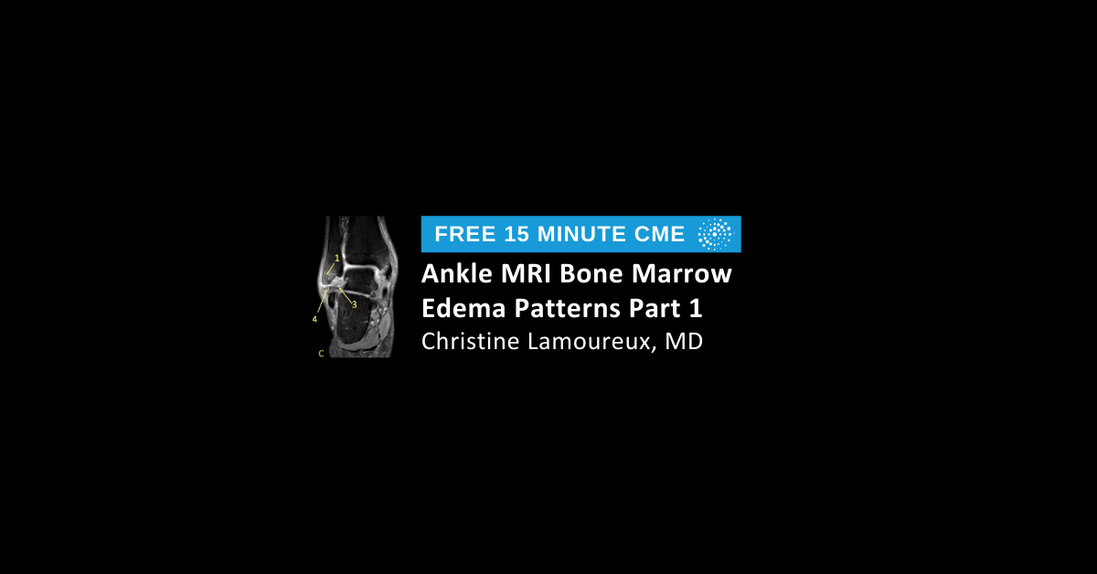 Ankle MRI Bone Marrow Edema Patterns Part 1: Traumatic